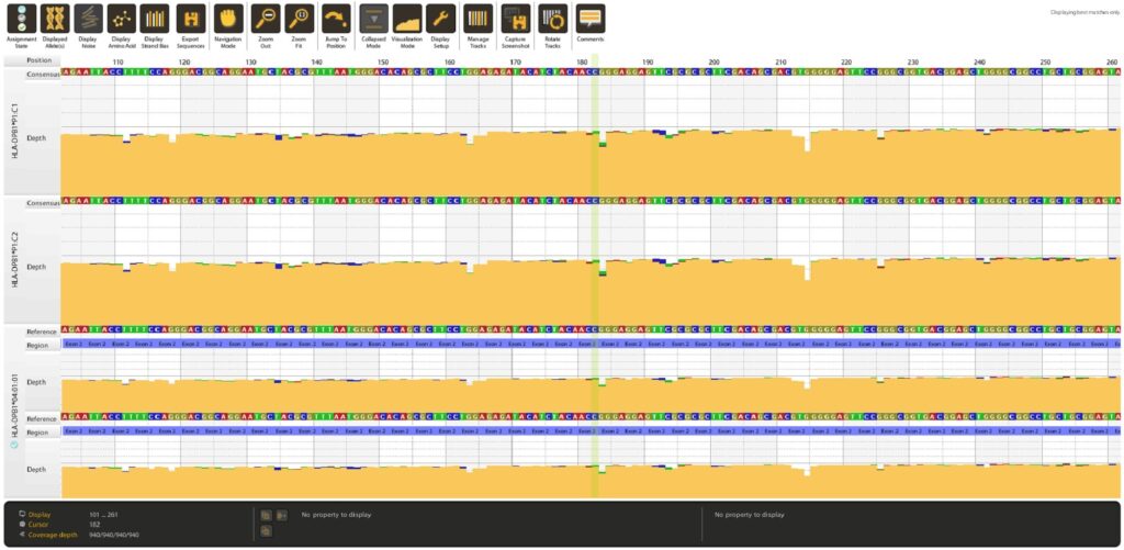 NanoTYPE™ from Omixon | Sample to Results in 5 hours | Oxford Nanopore ...